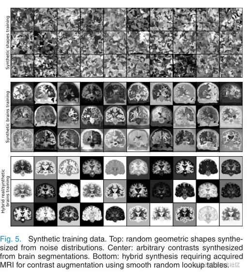 使用pytoch训练SynthMorph持续创作，加速成长！这是我参与「掘金日新计划 · 10 月更文挑战」的第11天， - 掘金